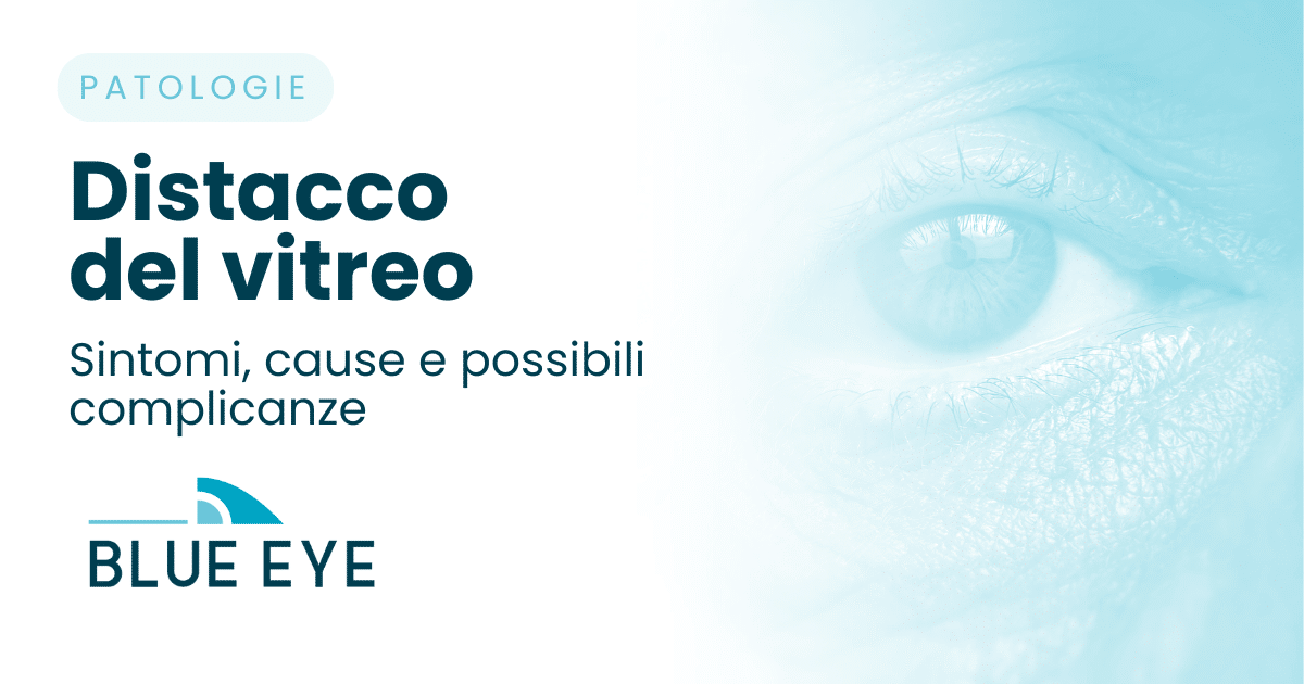 Distacco del Vitreo: Sintomi, Rischi e Diagnosi Precoce | BLUE EYE